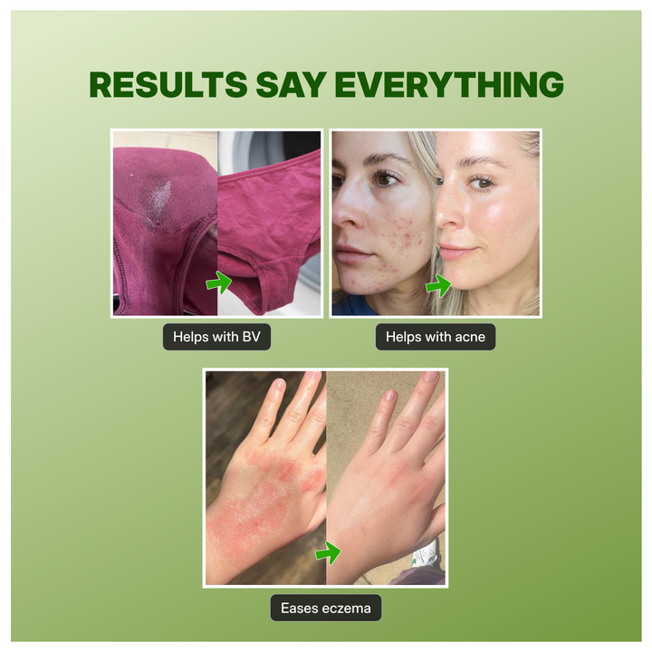 Products – Belano